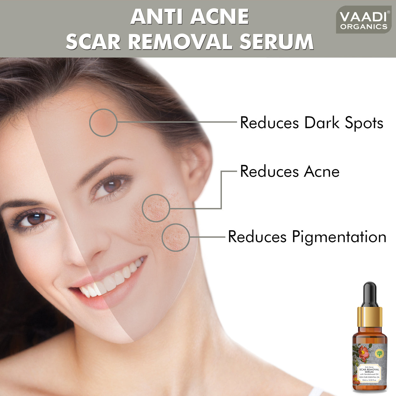 Scar Removal Serum (Pure Mix of Sandalwood Oil, Steam Distilled Neem ...